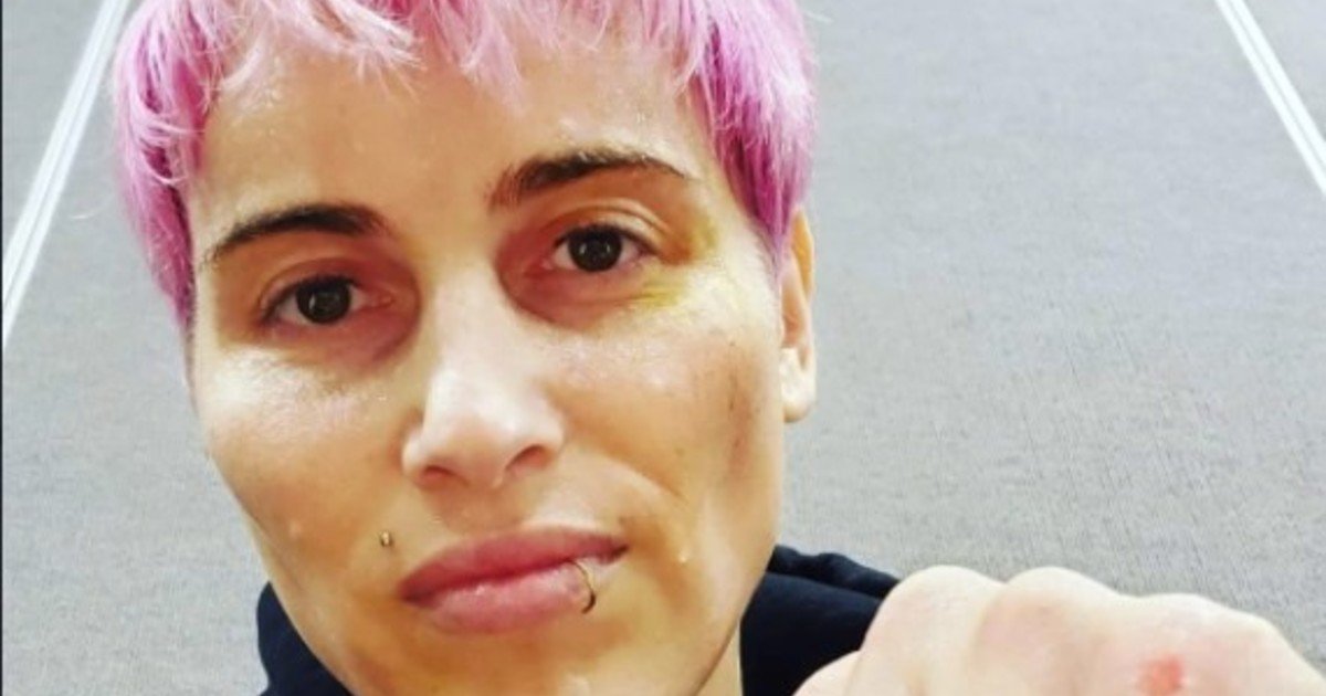 Alana McLaughlin cuenta su dura batalla contra los rechazos y el abuso ...